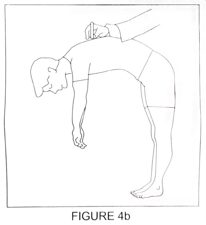 Guidelines for Use in Spinal Screening Programs