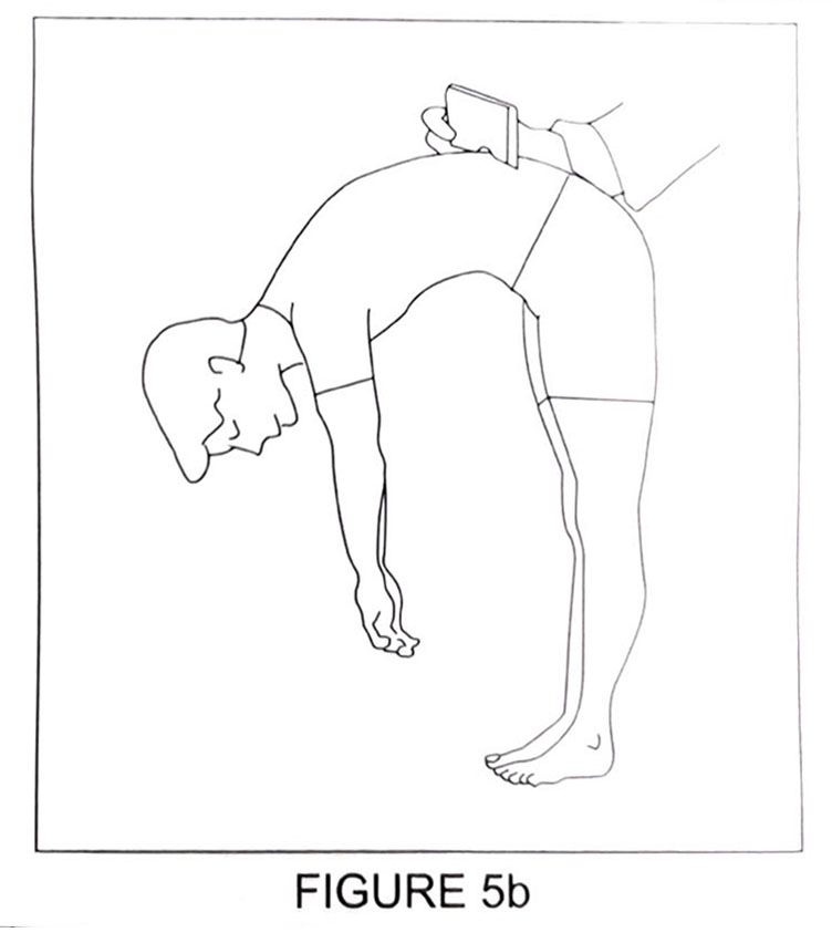 Guidelines for Use in Spinal Screening Programs